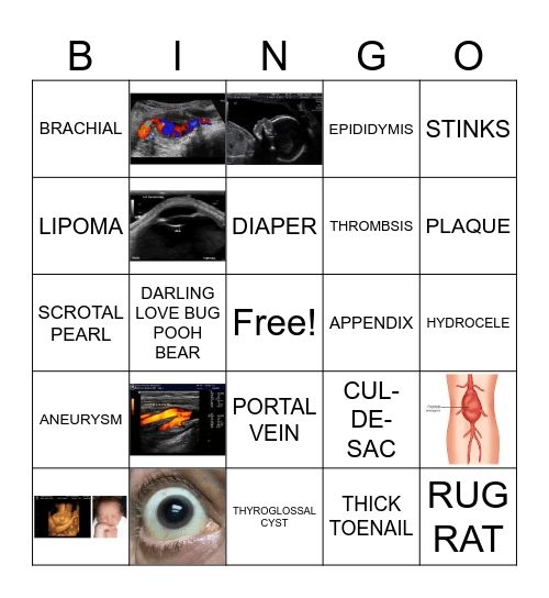 ULTRASOUND Bingo Card