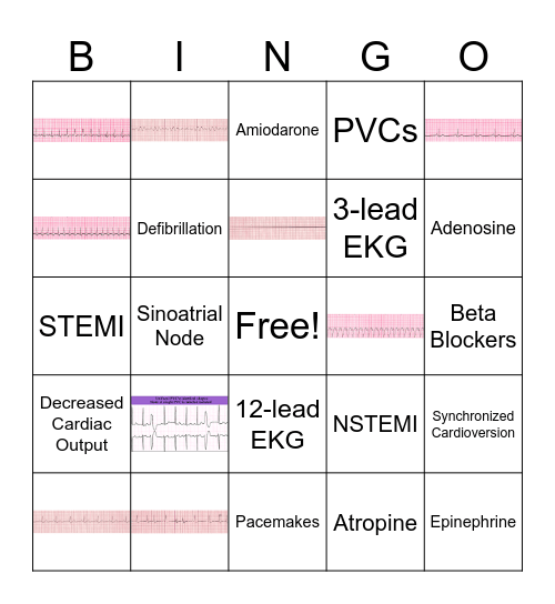 EKG Bingo Card