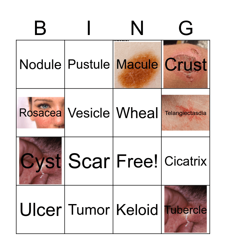 Skin Disorders Lesions Bingo Card
